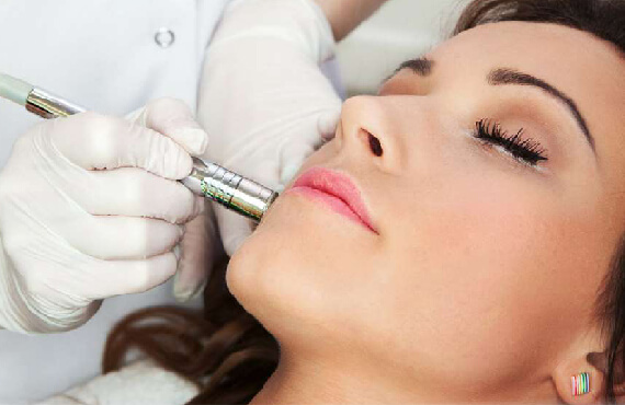 Microdermabrasion | Skin Exfoliation | London Aesthetic Beauty